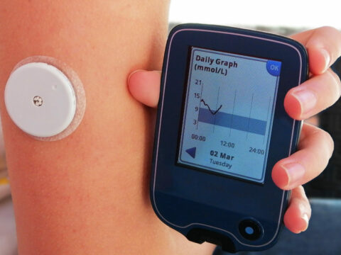 Come misurare la glicemia senza pungersi